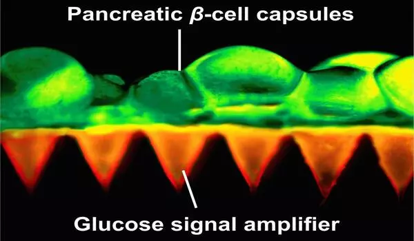 A Step closer to no-injection Diabetes Treatment – Insulin-producing ...